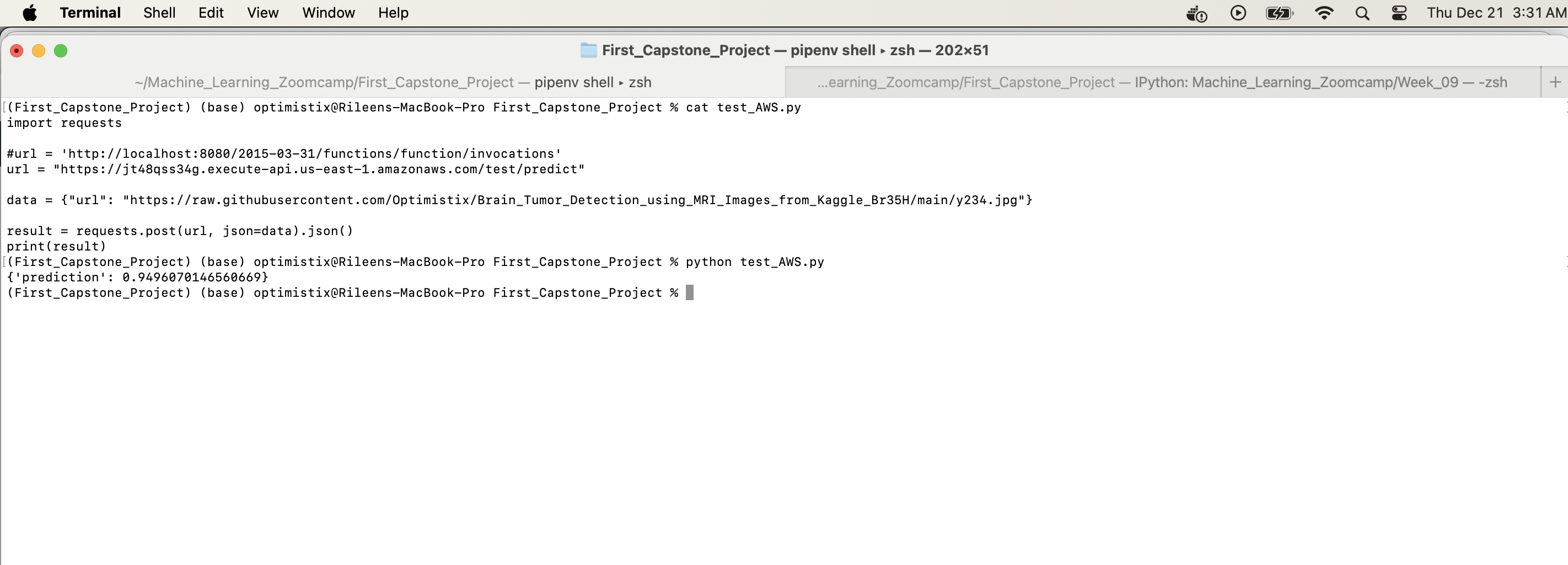 GitHub - Optimistix/Brain_Tumor_Detection_using_MRI_Images_from_Kaggle ...