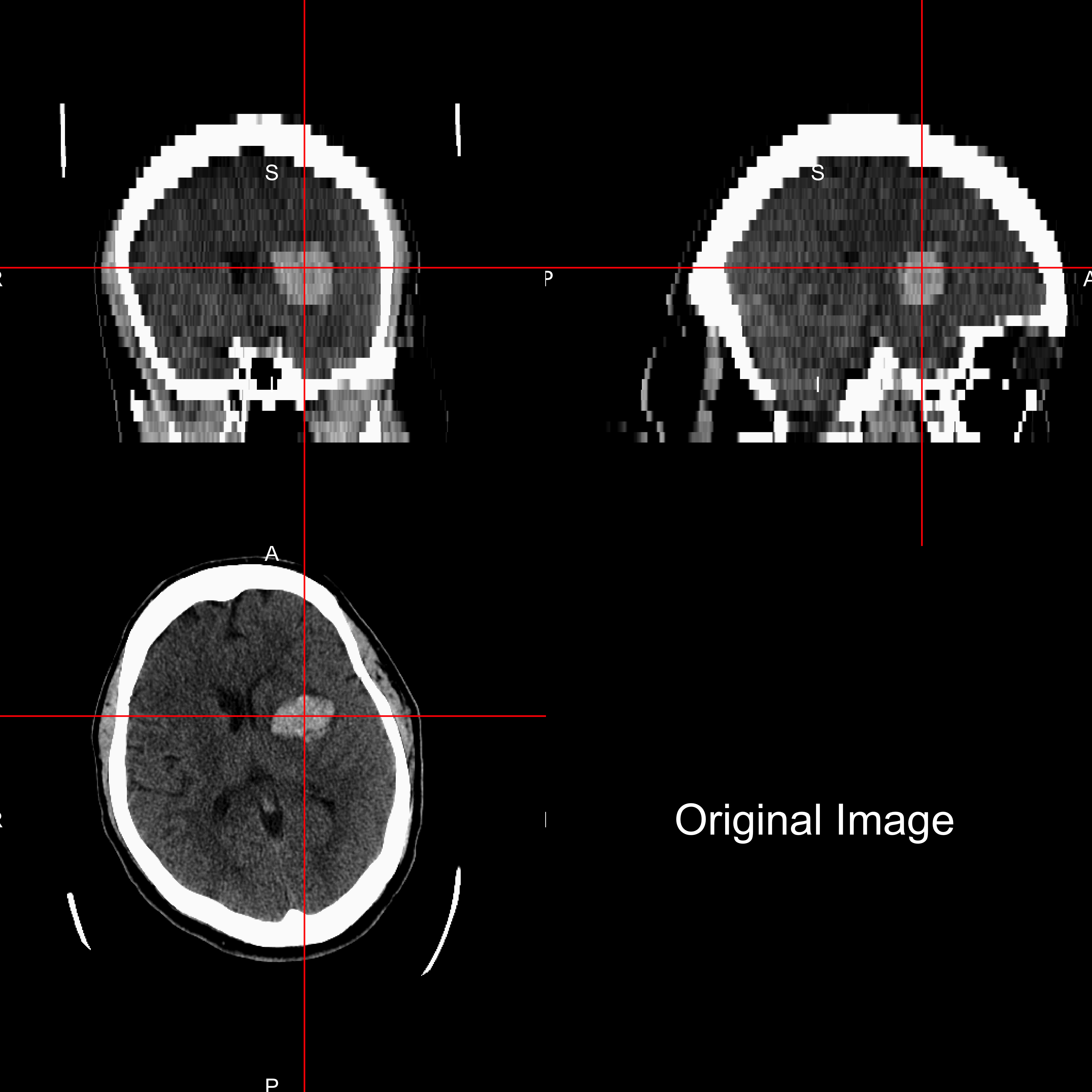 Neuroconductor: A Neuroimaging Analysis Project in R
